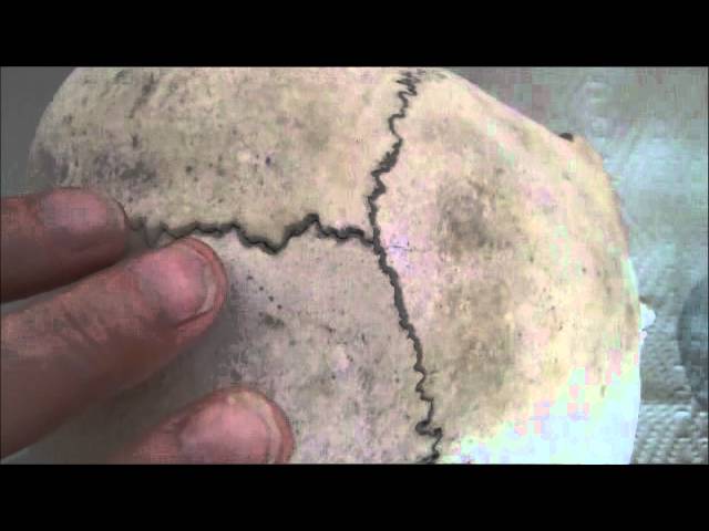 Lost Human Species Of Paracas Peru: Elongated Skulls - Hidden Inca Tours