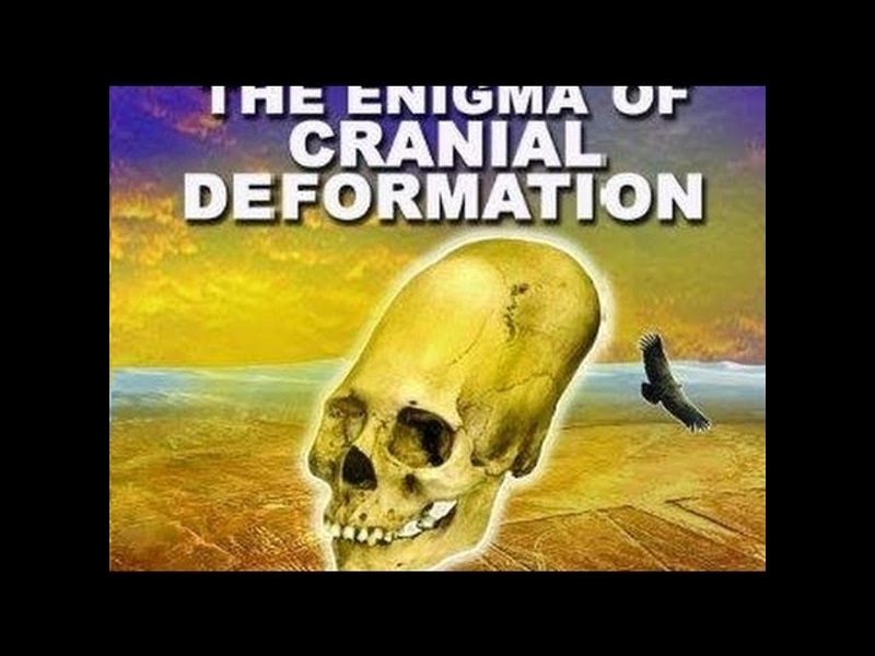 THE RUSSELL SCOTT SHOW: The ENIGMA of CRANIAL DEFORMATION w/ Brien ...