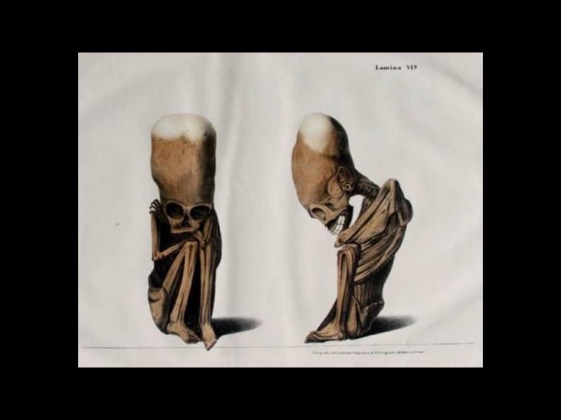 Explore The Elongated Skulls Of Peru In August 2017 - Hidden Inca Tours