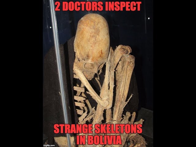Two American Doctors Inspect Strange Ancient Skeletons In Bolivia ...